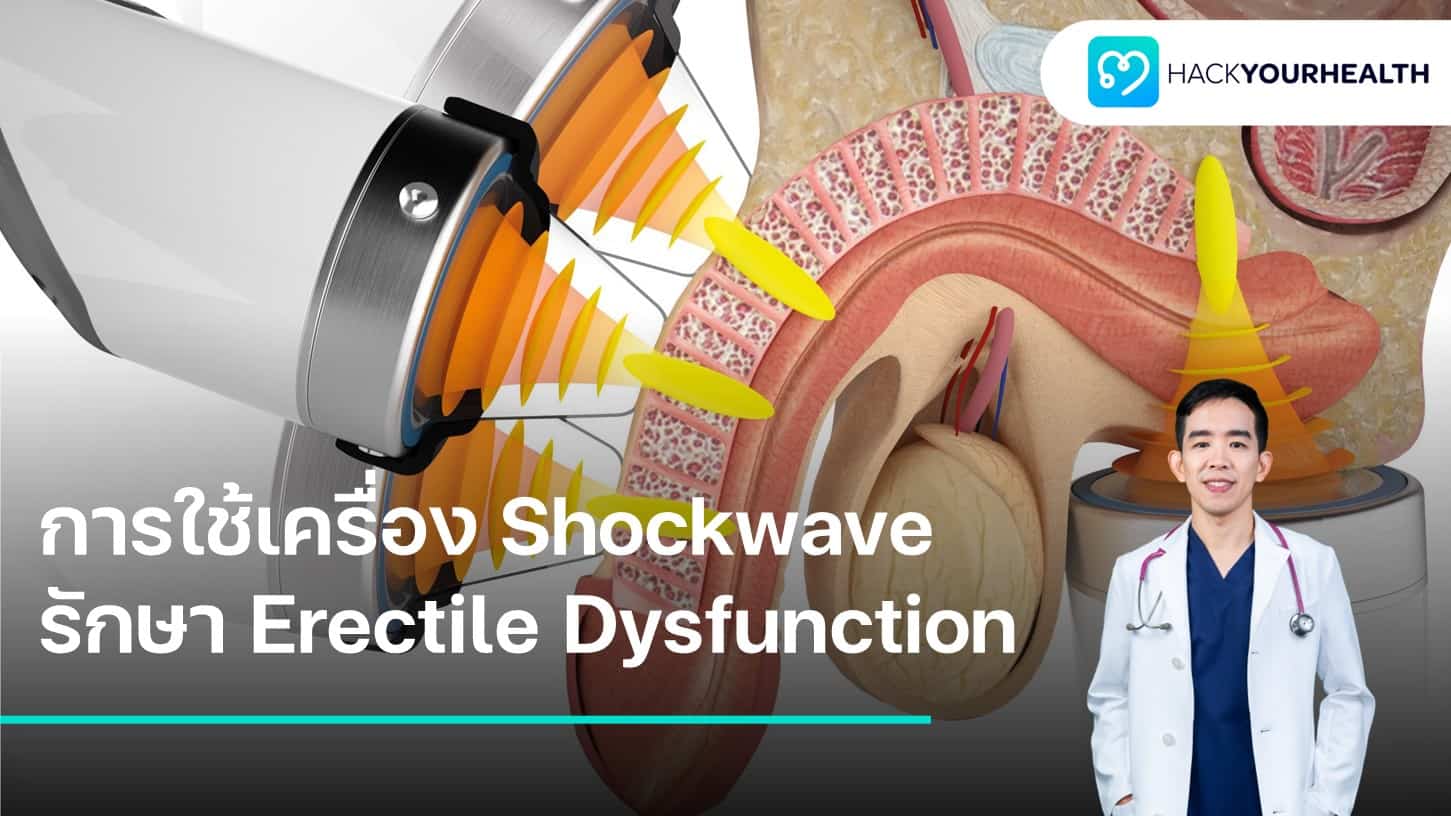 การใช้เครื่อง Shockwave รักษา ED | Hack Your Health