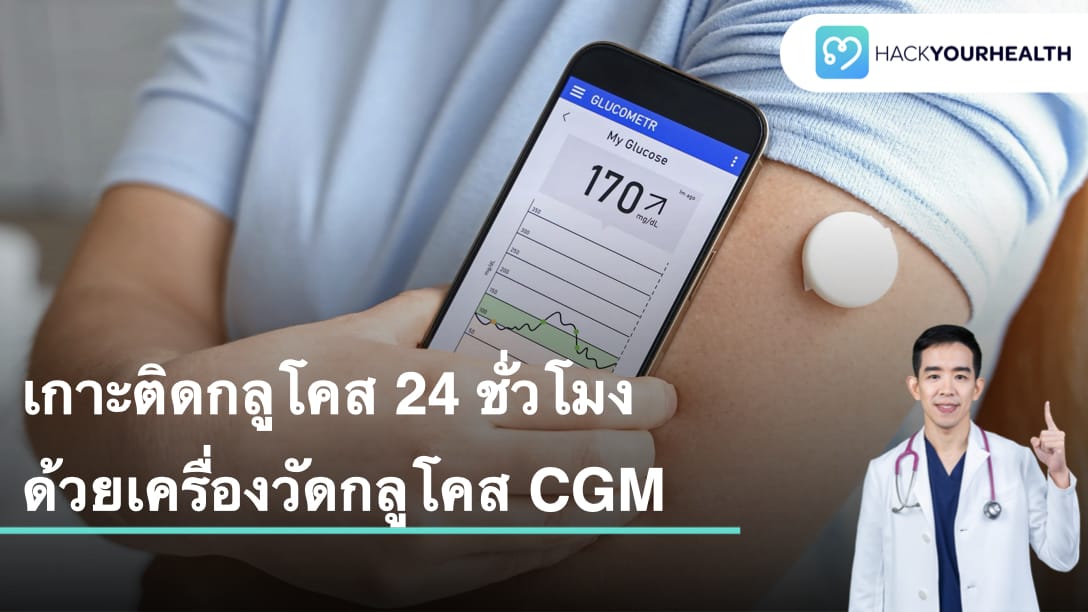 เกาะติดกลูโคส 24 ชั่วโมงด้วยเครื่องวัดกลูโคส CGM | Hack Your Health